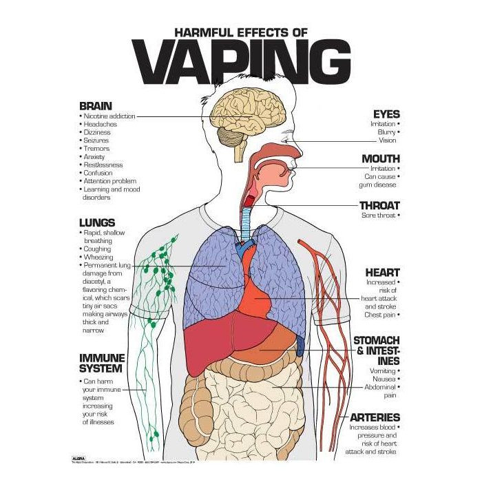 Harmful Effects of Vaping, 24" x 36" Laminated Poster