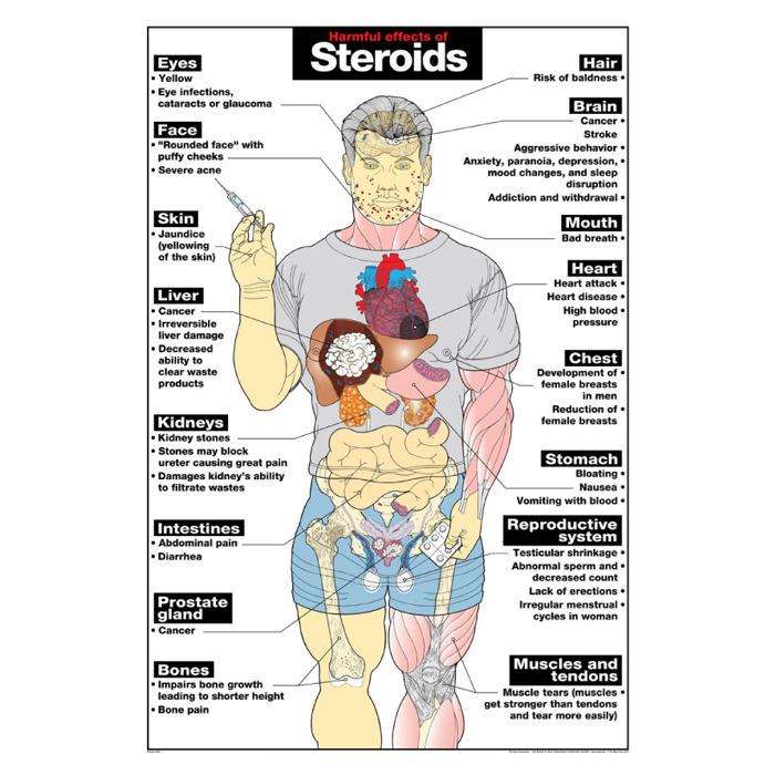 Harmful Effects of Steroids Laminated Poster