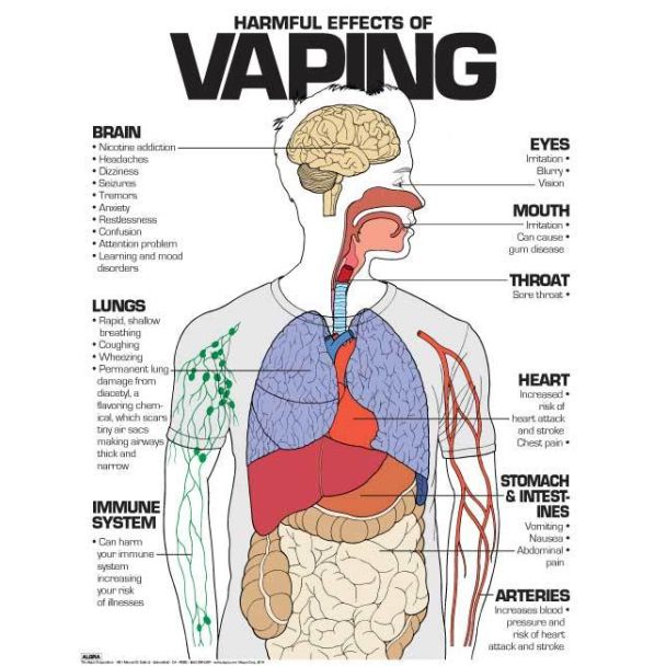 Harmful Effects of Vaping, 24" x 36" Laminated Poster